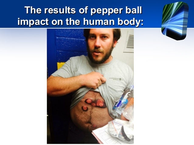 Use of Force Guidelines- Pepperball Gun- Urban Riot- Richard Garrity