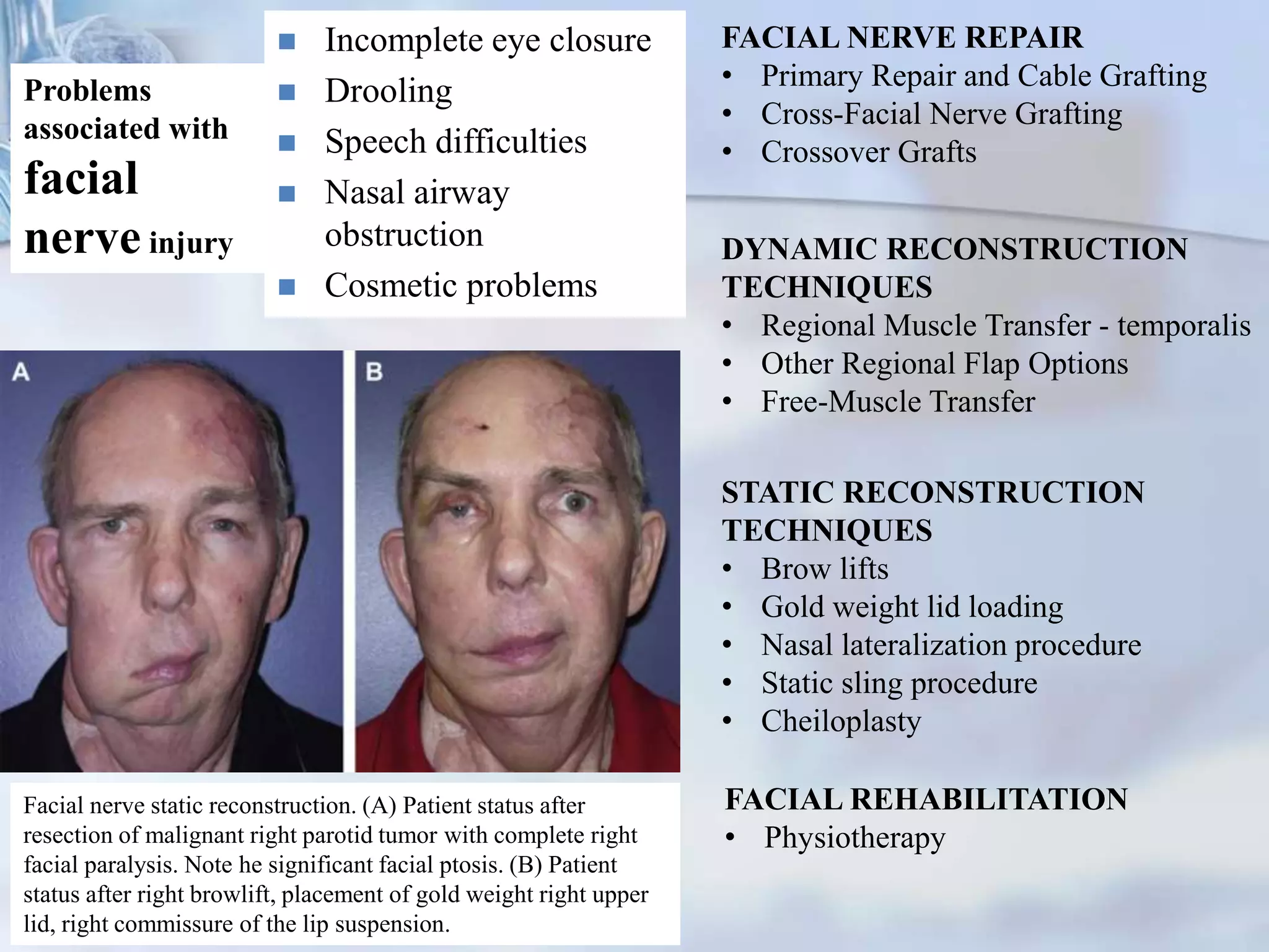 Use of grafts & alloplastic material in maxillofacial trauma | PPTX