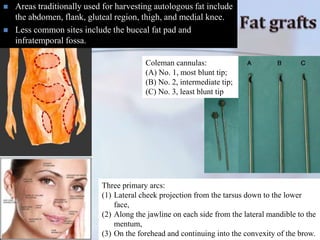 Use of grafts & alloplastic material in maxillofacial trauma | PPTX