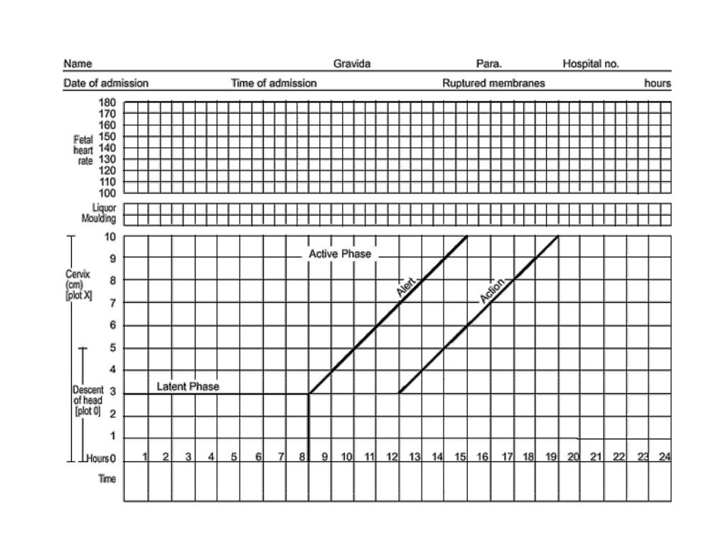 Use of partogram in labour management