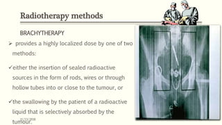 Uses of radiation to man | PPT