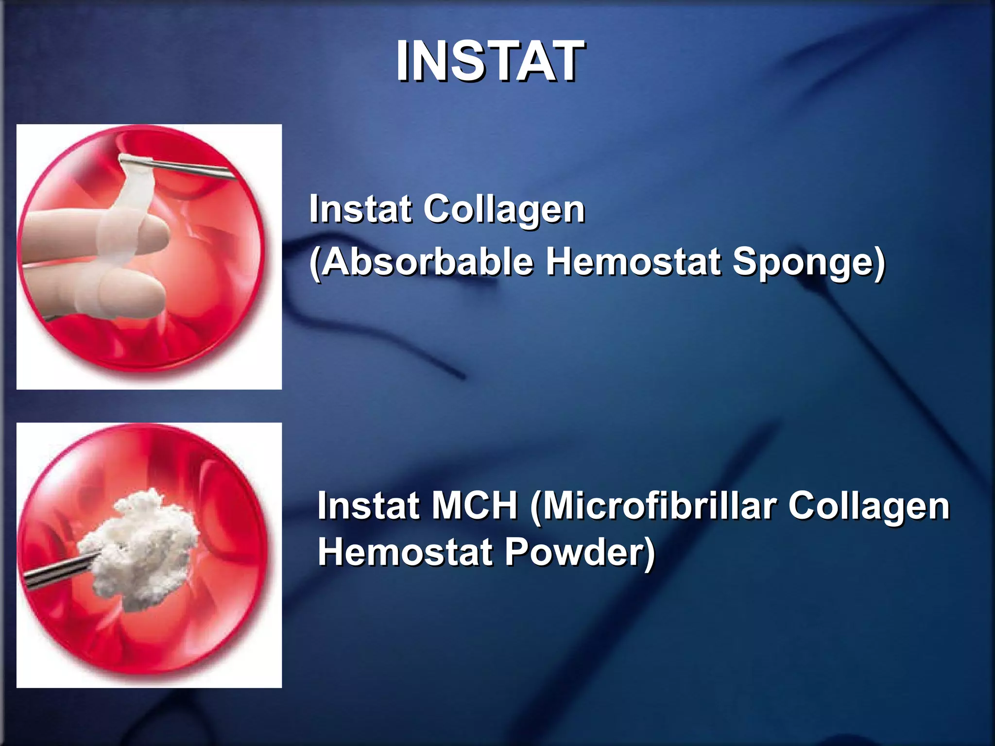 Use Of Tissue Sealants And Hemostatic Agents | PPT