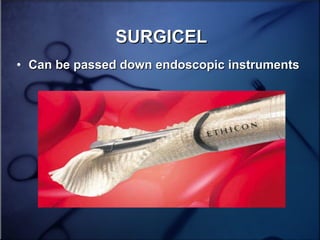 Use Of Tissue Sealants And Hemostatic Agents | PPT