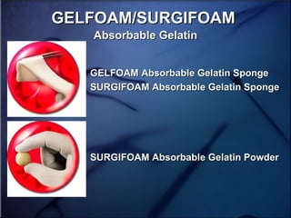 Use Of Tissue Sealants And Hemostatic Agents | PPT