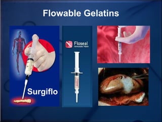 Use Of Tissue Sealants And Hemostatic Agents | PPT