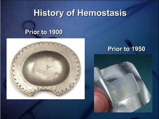 Use Of Tissue Sealants And Hemostatic Agents | PPT