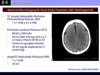 Prefusion cerebral. EKT | PPT