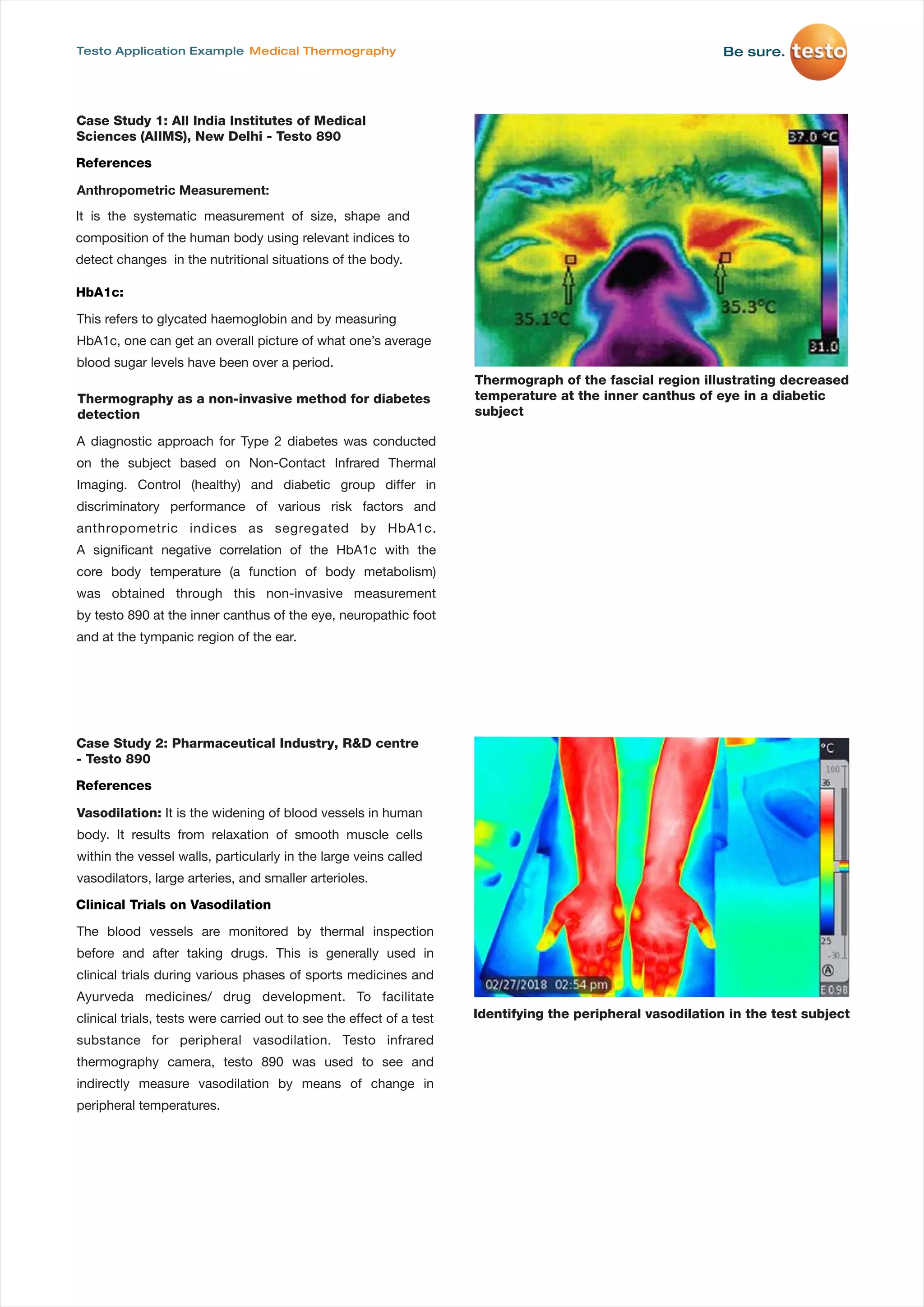 Medical Thermography and its applications in Medical & Clinical ...