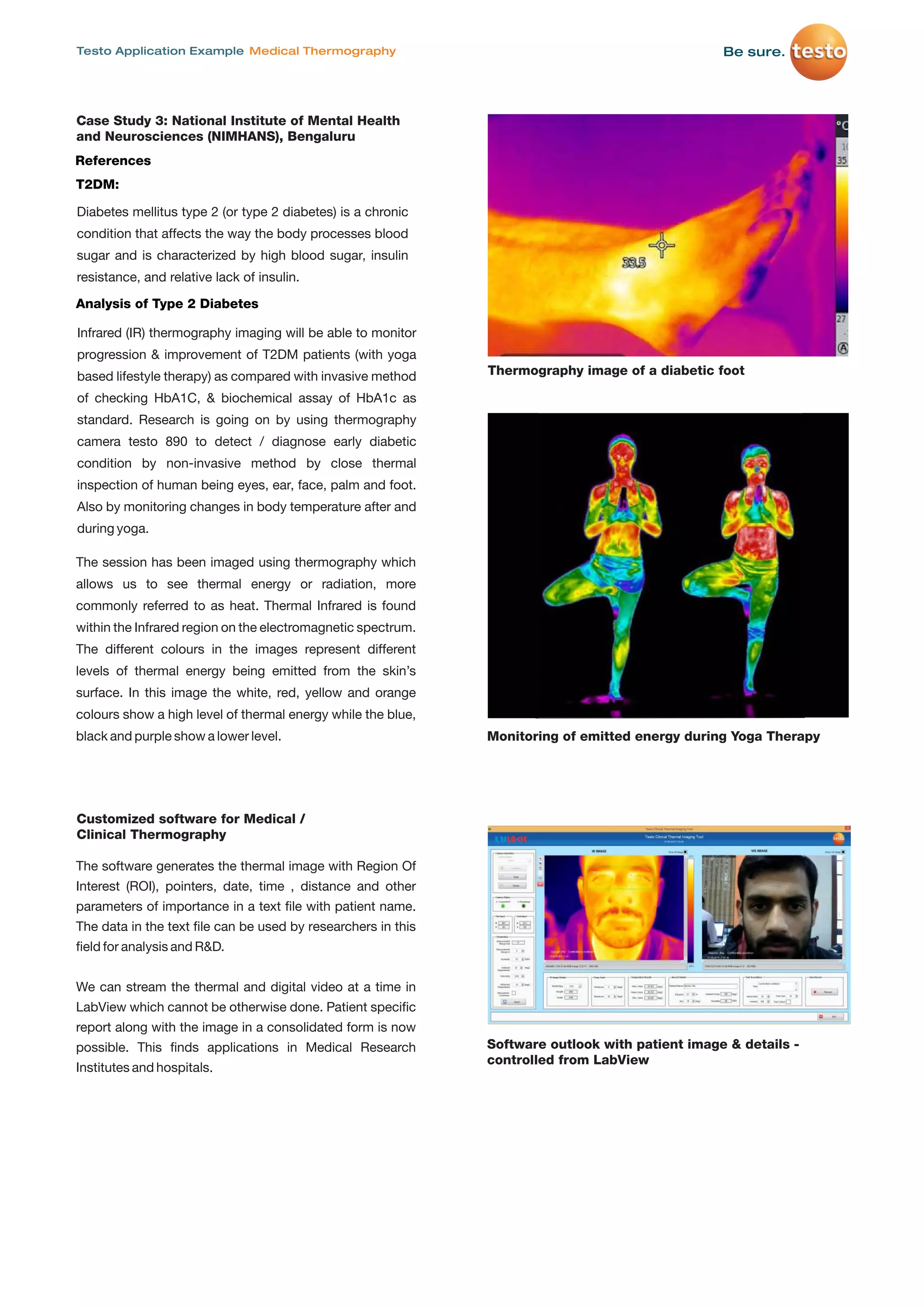 Medical Thermography and its applications in Medical & Clinical ...