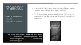 ULTRASONIDO ESCROTAL (US TESTICULAR) | PPTX