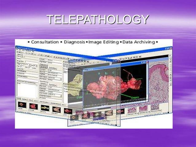 Uses of computer in hospitals and community.ppt | Computer Software and ...