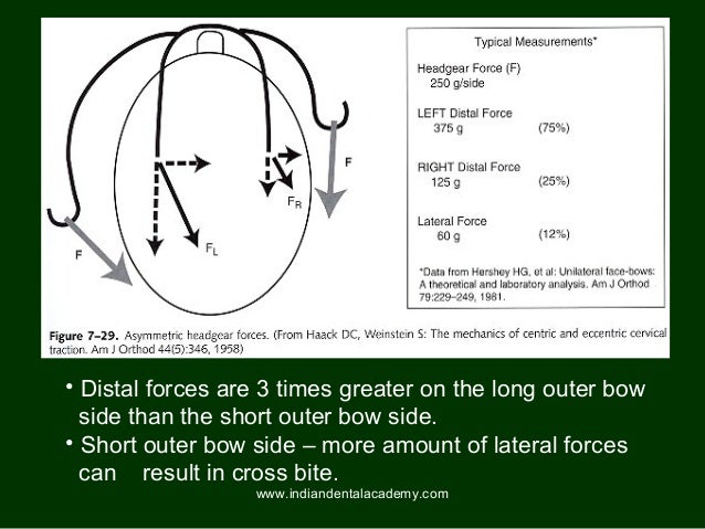 Uses of head gears in growing skeletal class /certified fixed ortho…