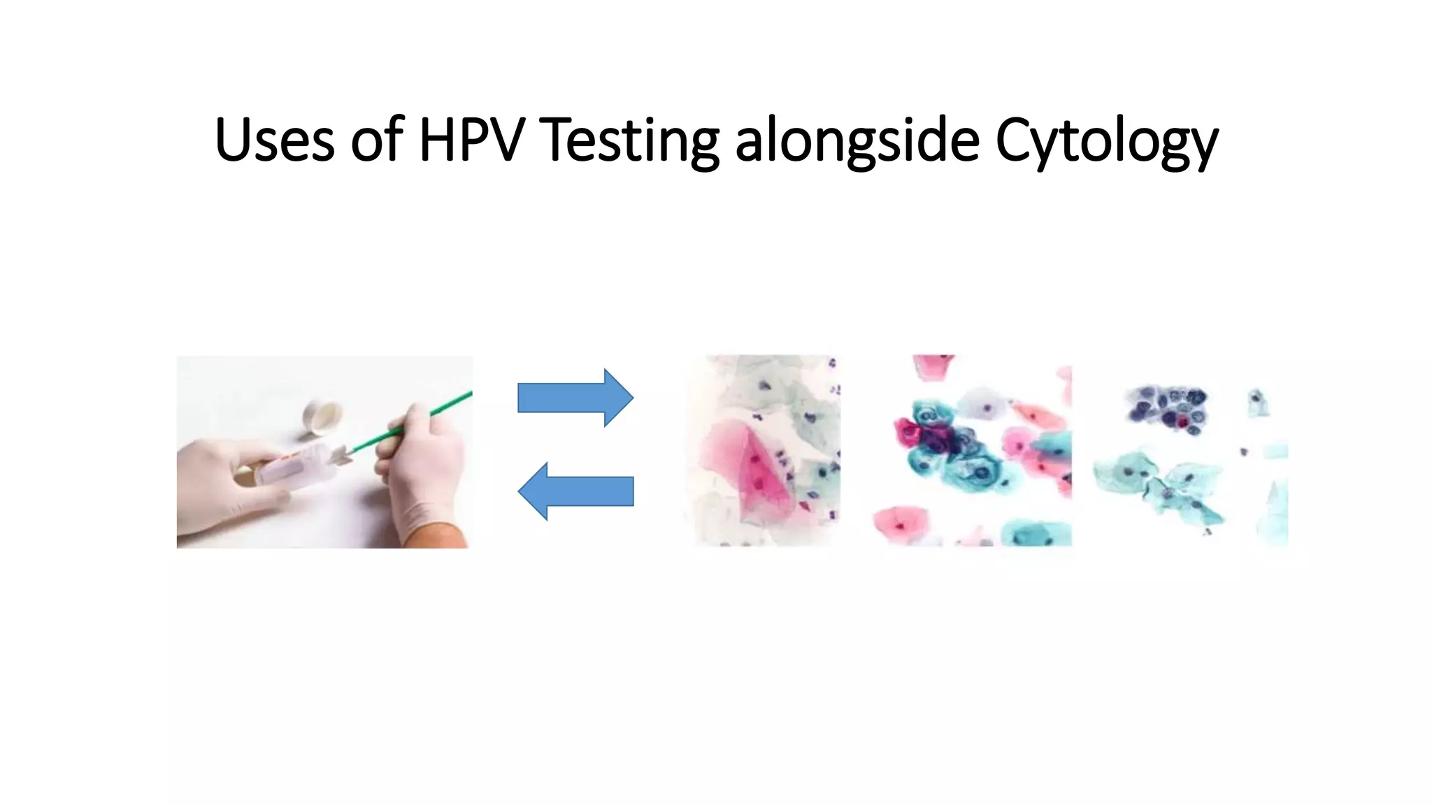 Uses of HPV Testing in Triage of cervical Screening | PPT