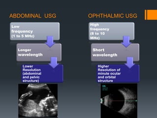 Usg | PPTX