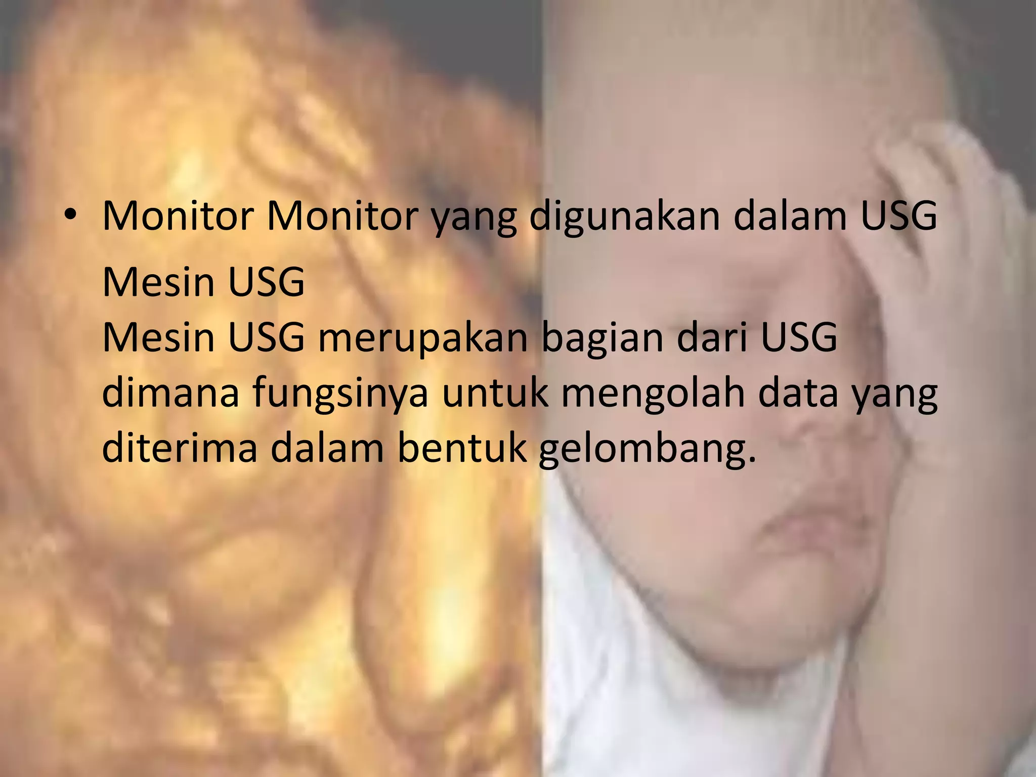 Persiapan Pemeriksaan USG Ultrasonografi | PPTX