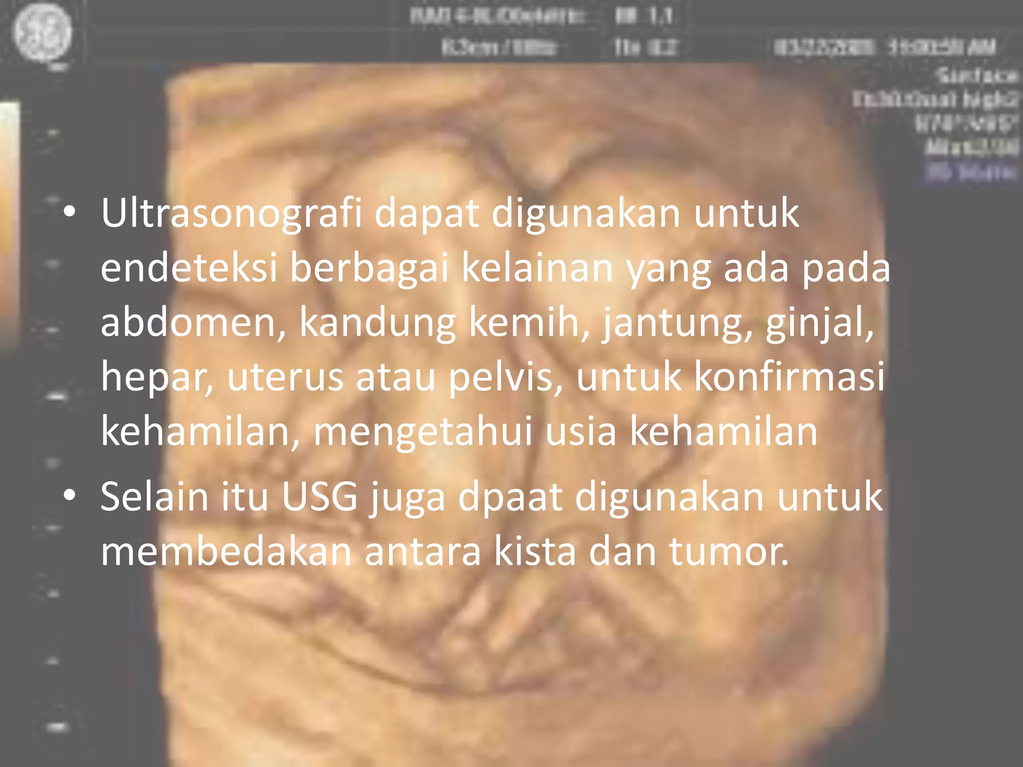 Persiapan Pemeriksaan USG Ultrasonografi | PPTX