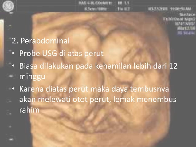 Persiapan Pemeriksaan USG Ultrasonografi | PPTX
