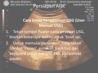 Persiapan Pemeriksaan USG Ultrasonografi | PPTX