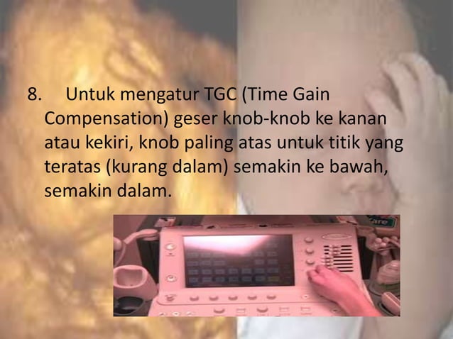 Persiapan Pemeriksaan USG Ultrasonografi | PPTX