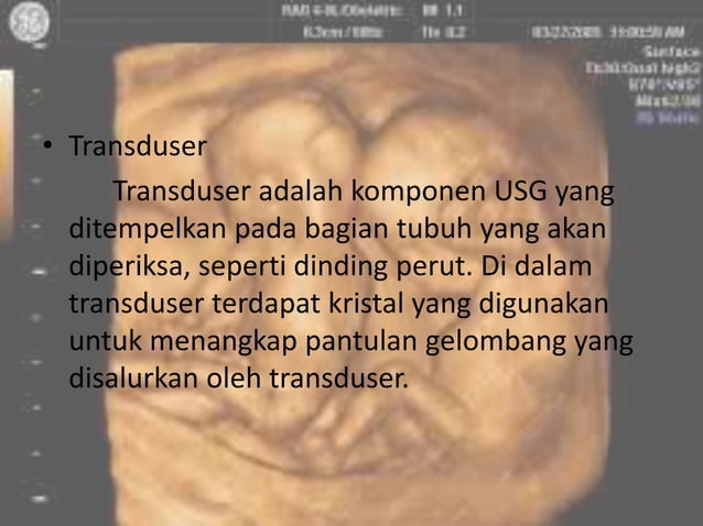 Persiapan Pemeriksaan USG Ultrasonografi | PPTX