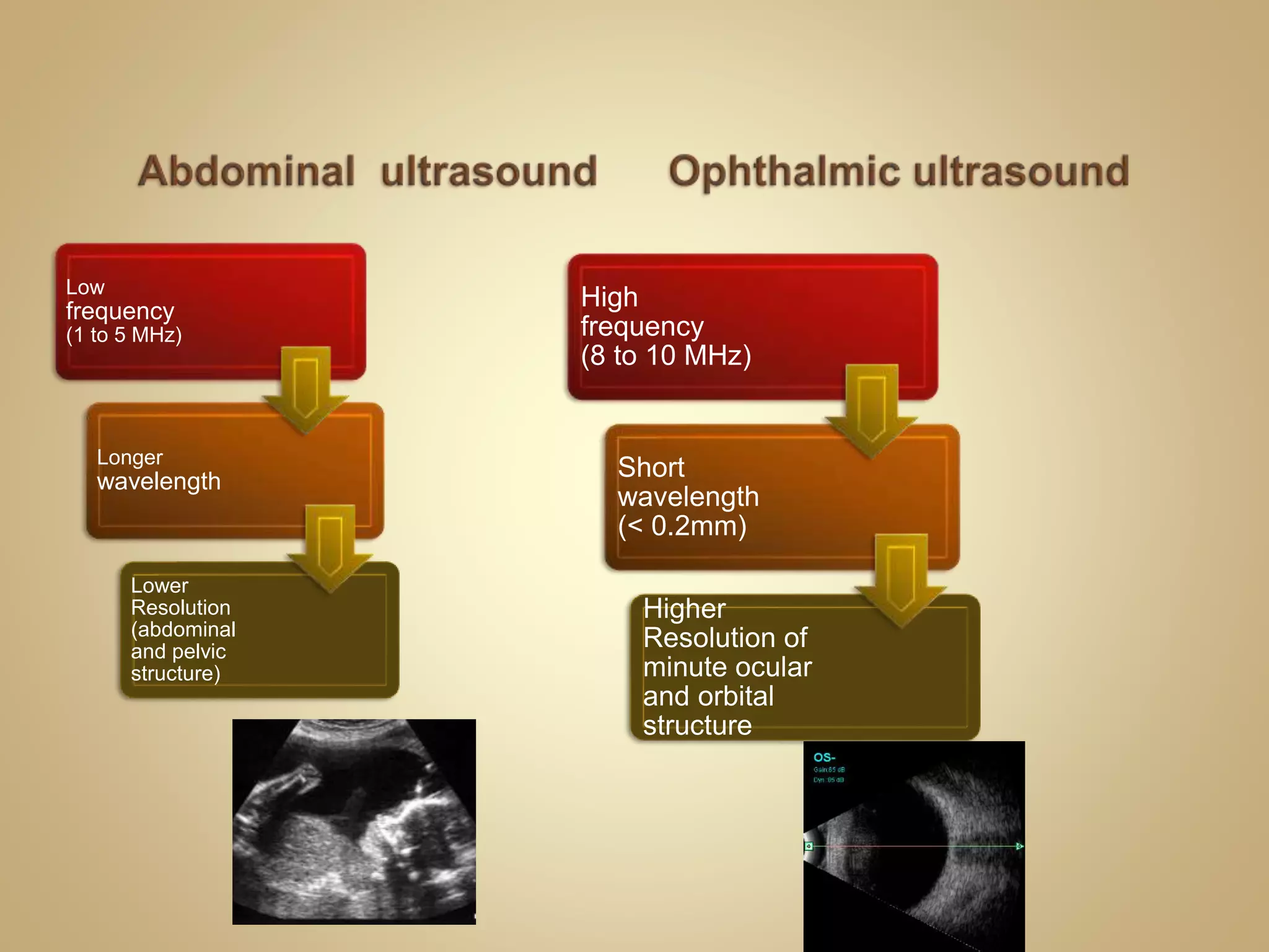 Ocular Ultrasound | PPTX