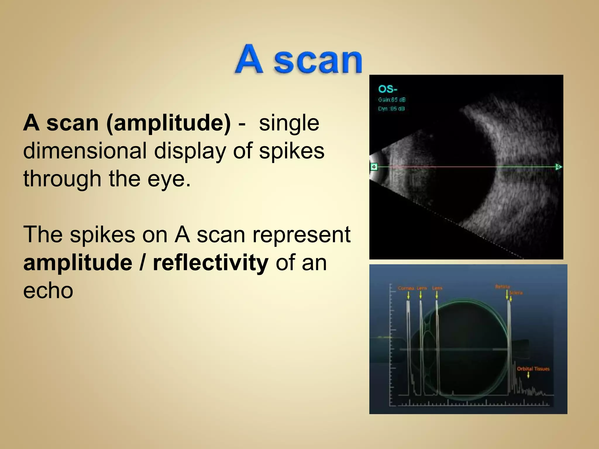 Ocular Ultrasound | PPTX