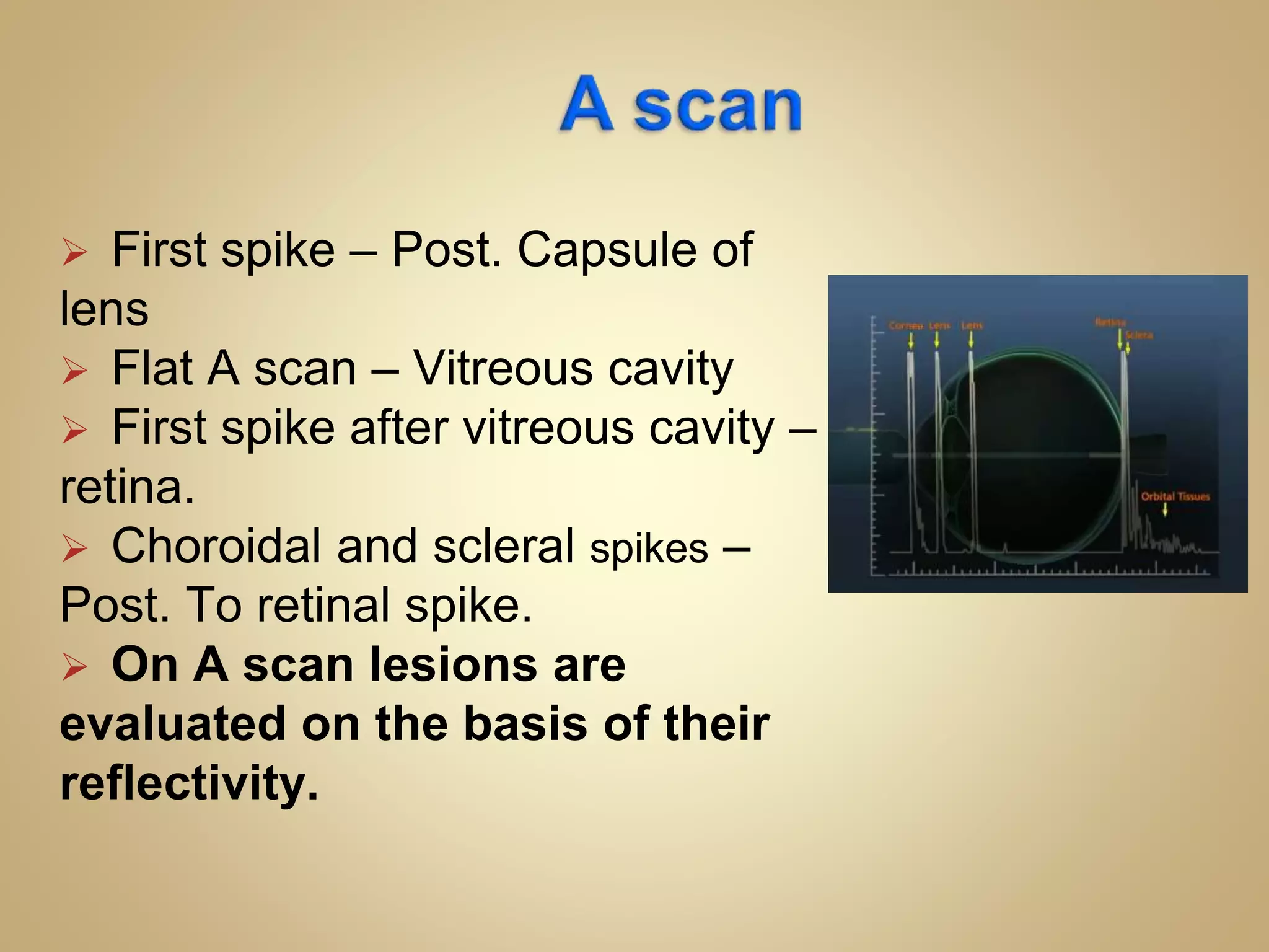 Ocular Ultrasound | PPTX
