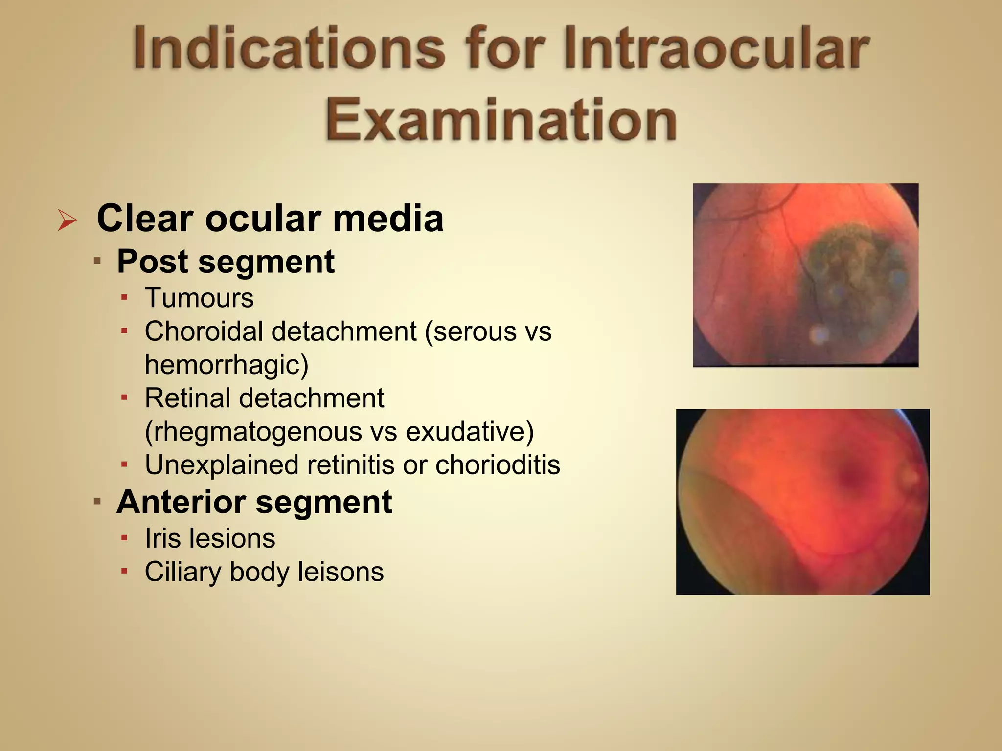 Ocular Ultrasound | PPTX