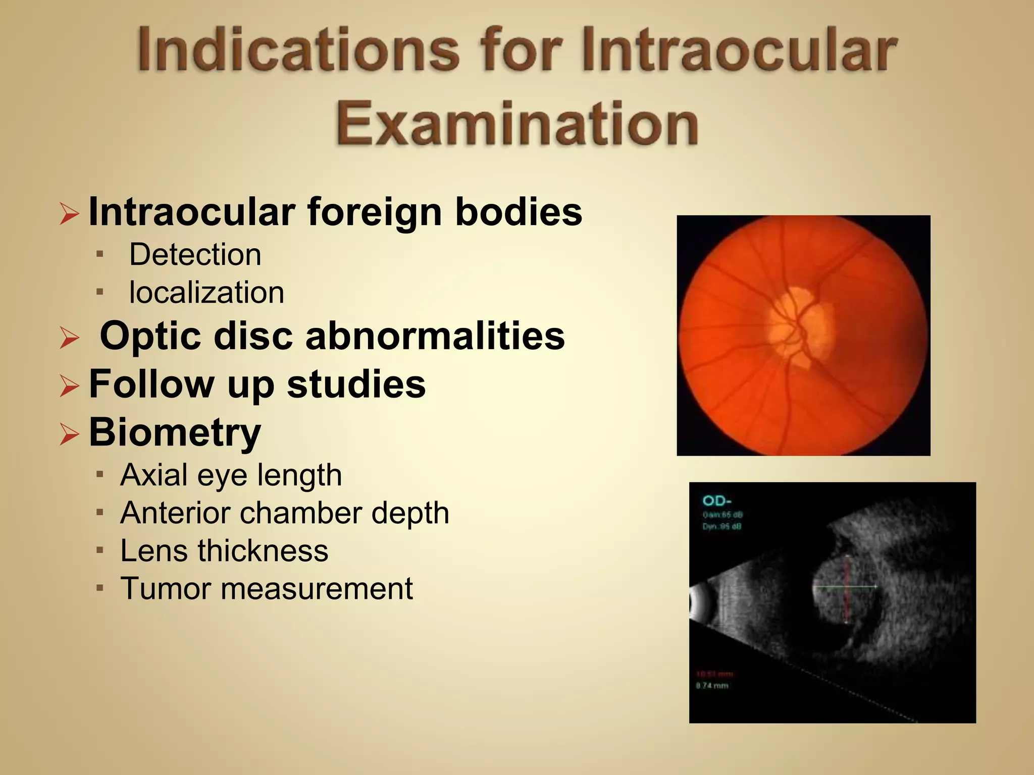 Ocular Ultrasound | PPTX