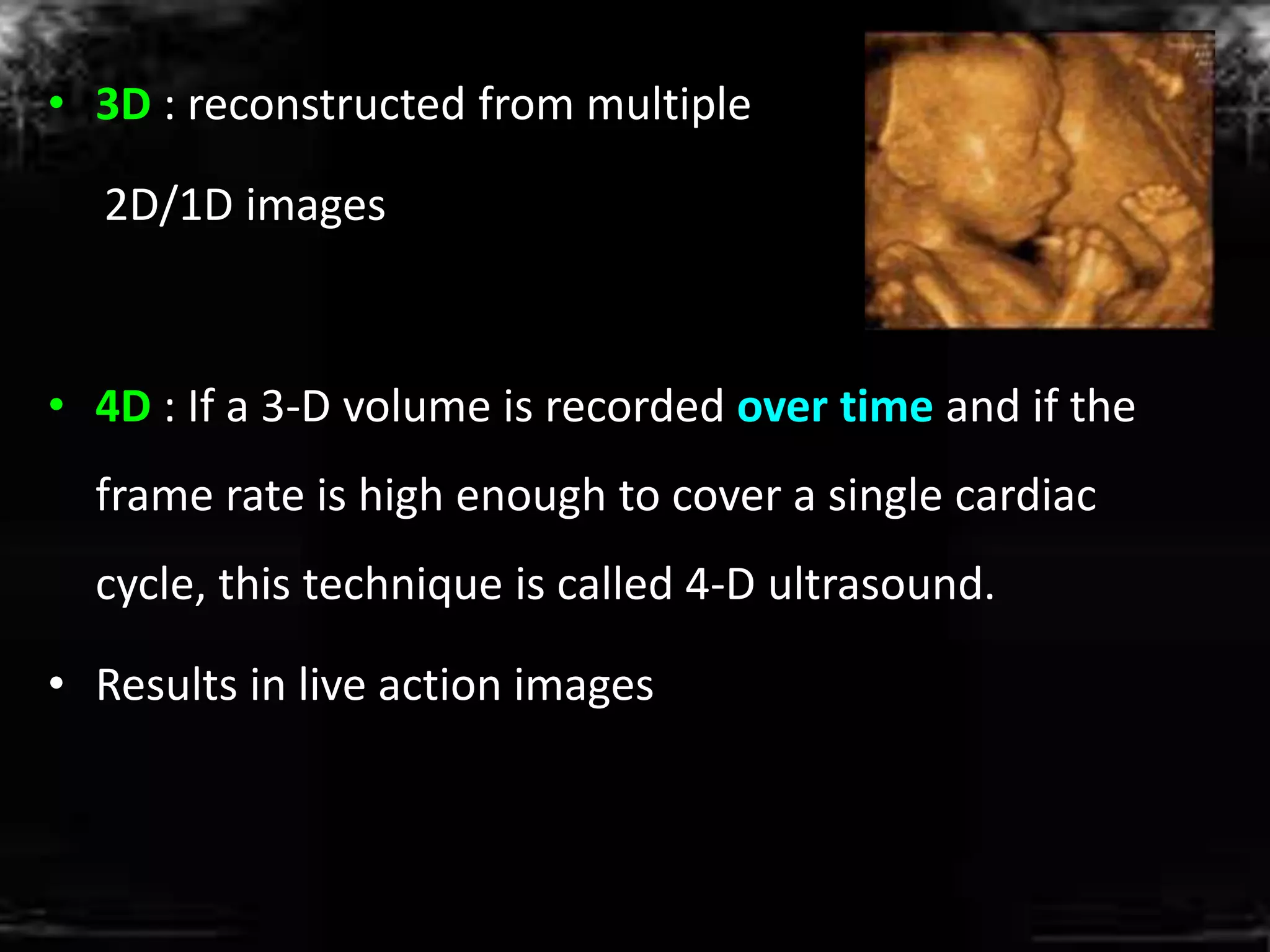 Ultrasonography | PPTX