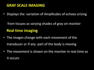 Ultrasonography | PPTX