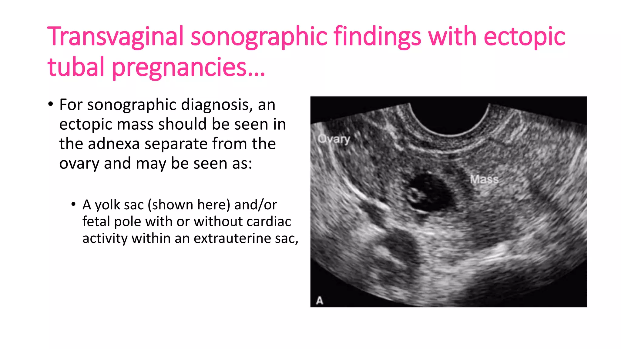 Ultrasound and usg doppler in obstetrics | PPTX