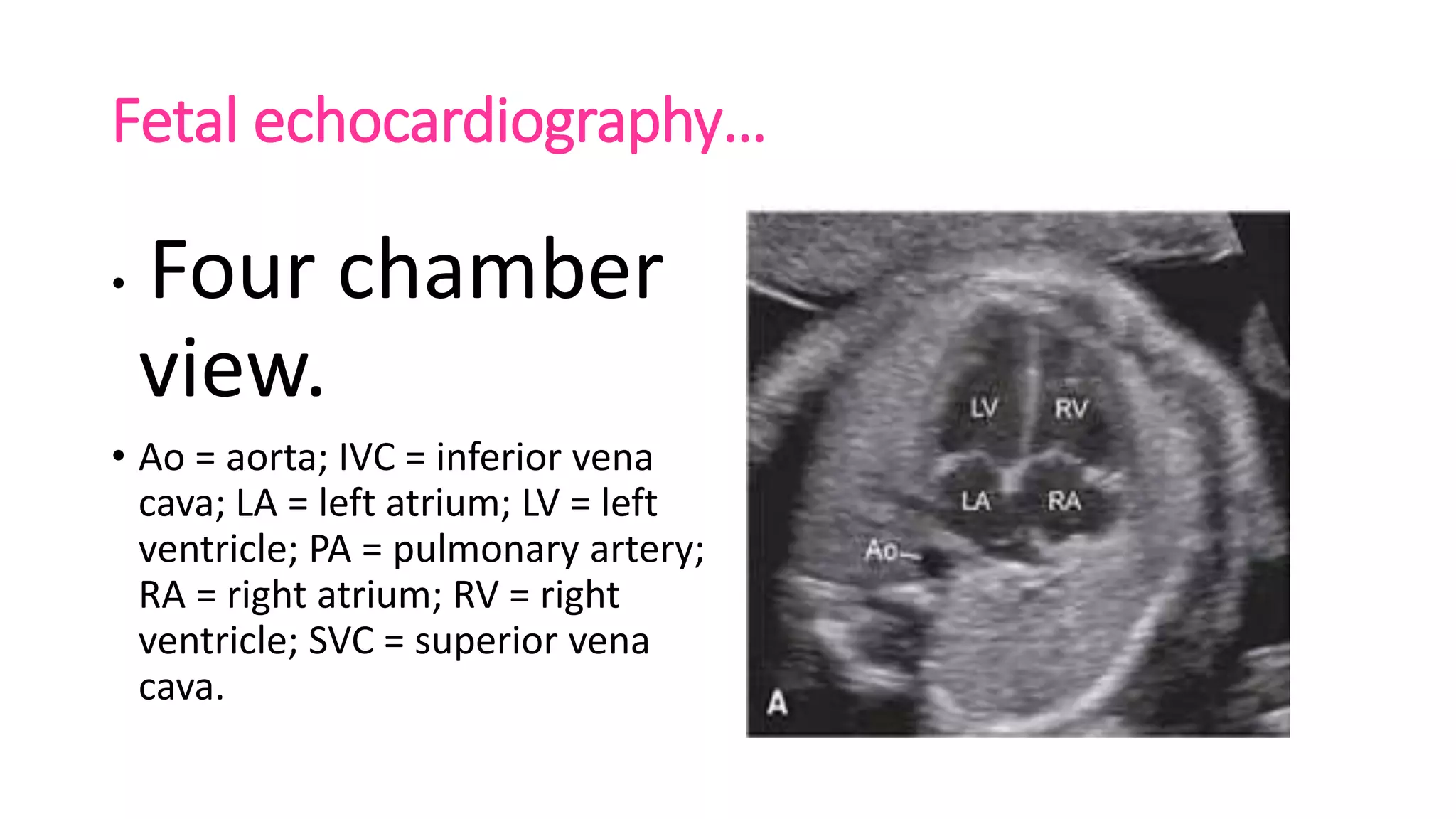 Ultrasound and usg doppler in obstetrics | PPTX