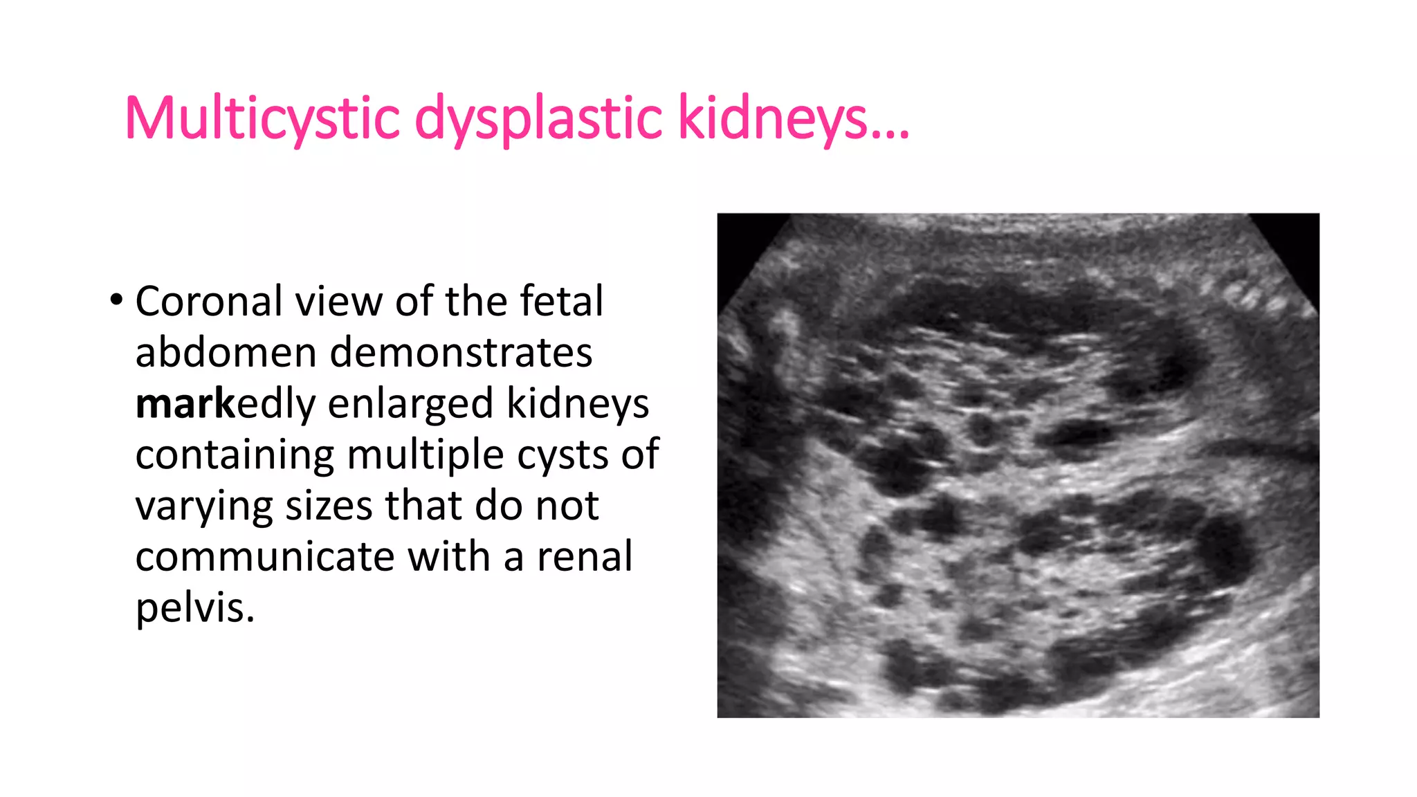 Ultrasound and usg doppler in obstetrics | PPTX