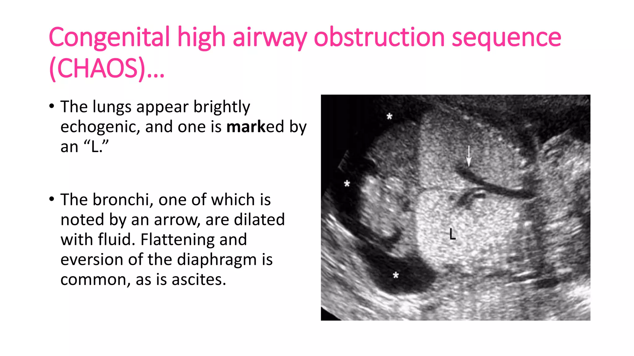 Ultrasound and usg doppler in obstetrics | PPTX