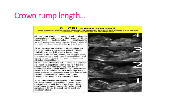 Ultrasound and usg doppler in obstetrics | PPTX | Pregnancy ...