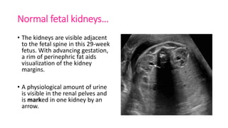 Ultrasound and usg doppler in obstetrics | PPTX