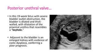 Ultrasound and usg doppler in obstetrics | PPTX