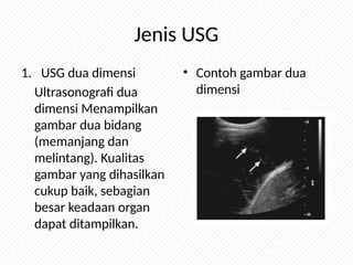 Komponen yang terdapat dalam alat diagnosa USG.pptx