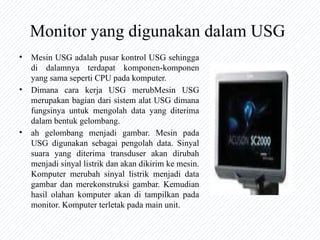 Komponen yang terdapat dalam alat diagnosa USG.pptx
