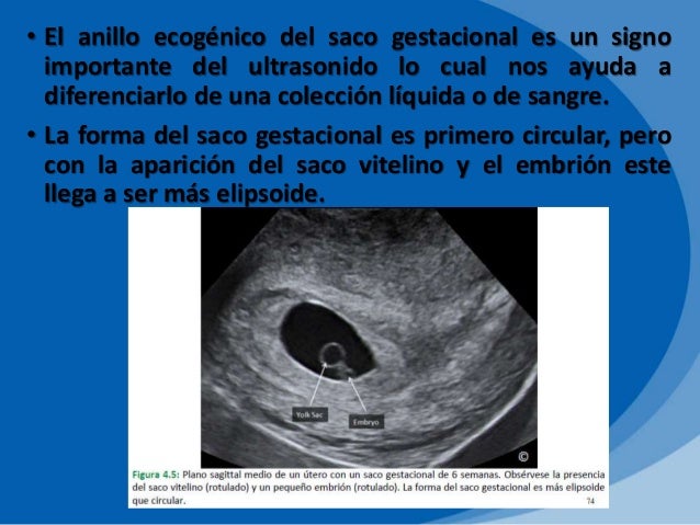 Ultrassom Do Saco Vitelino Humano