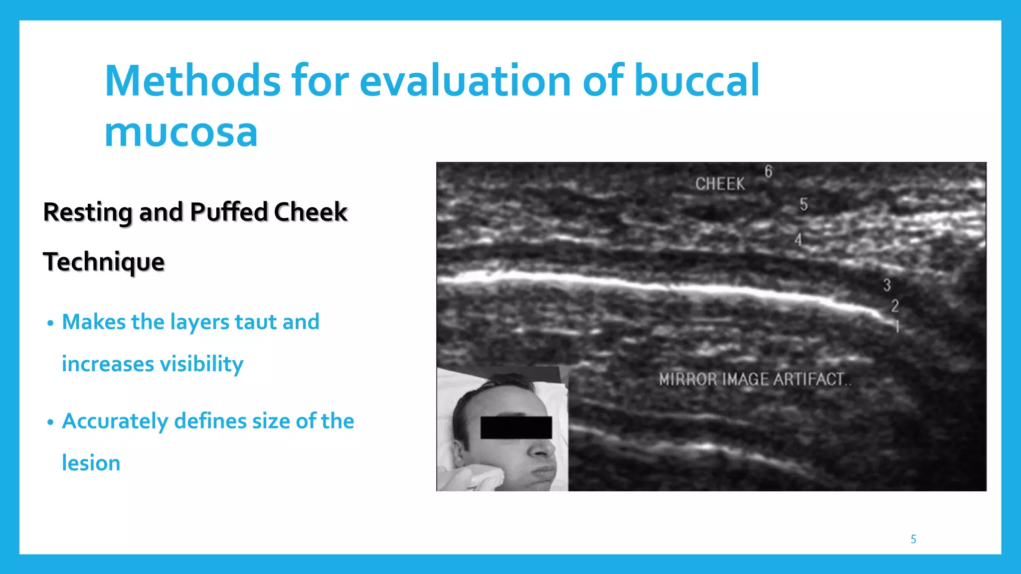 Ultrasonography - Head and Neck applications | PPTX