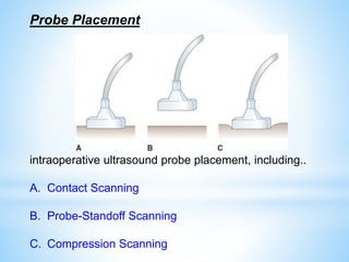 Usg 4 surgeons | PPT