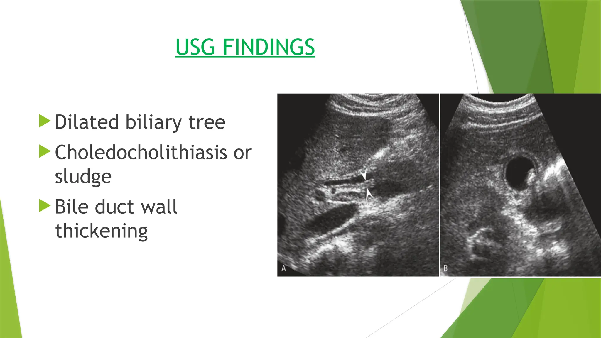 USG Acute abdomen radiology imaging .pptx