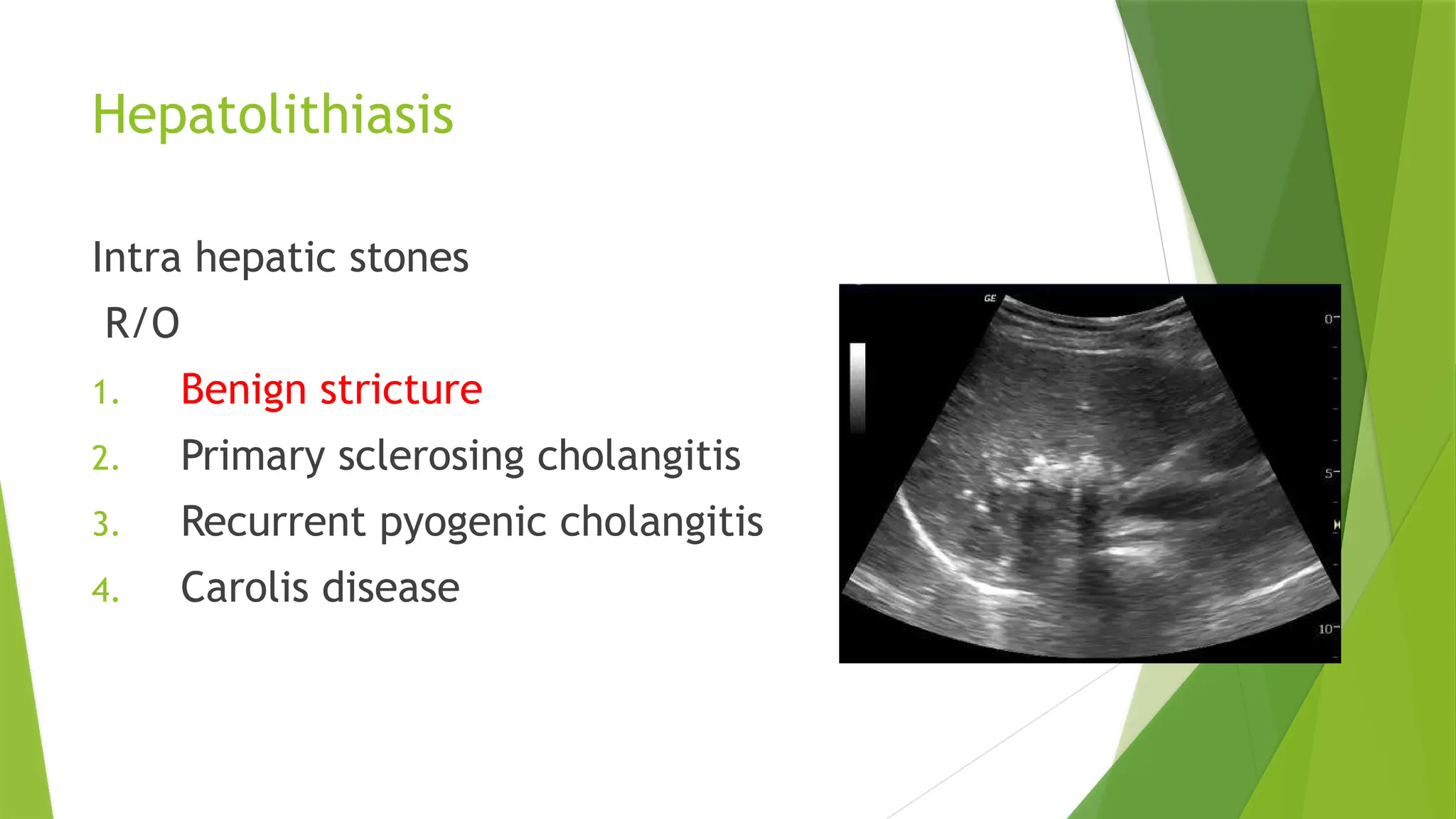 USG Acute abdomen radiology imaging .pptx