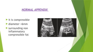 USG Acute abdomen radiology imaging .pptx