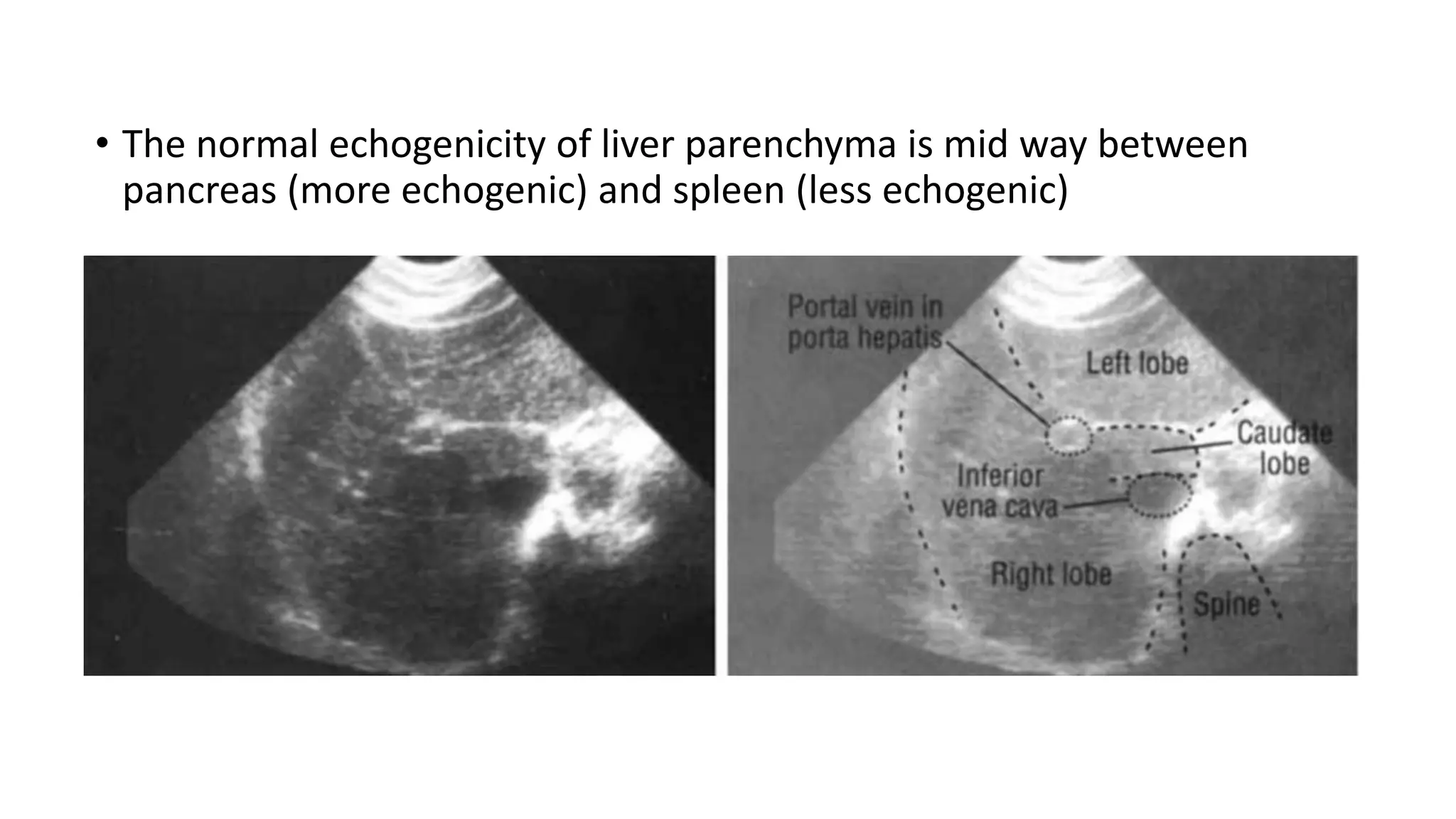Ultrasound Normal Anatomy of Major Organs | PPTX