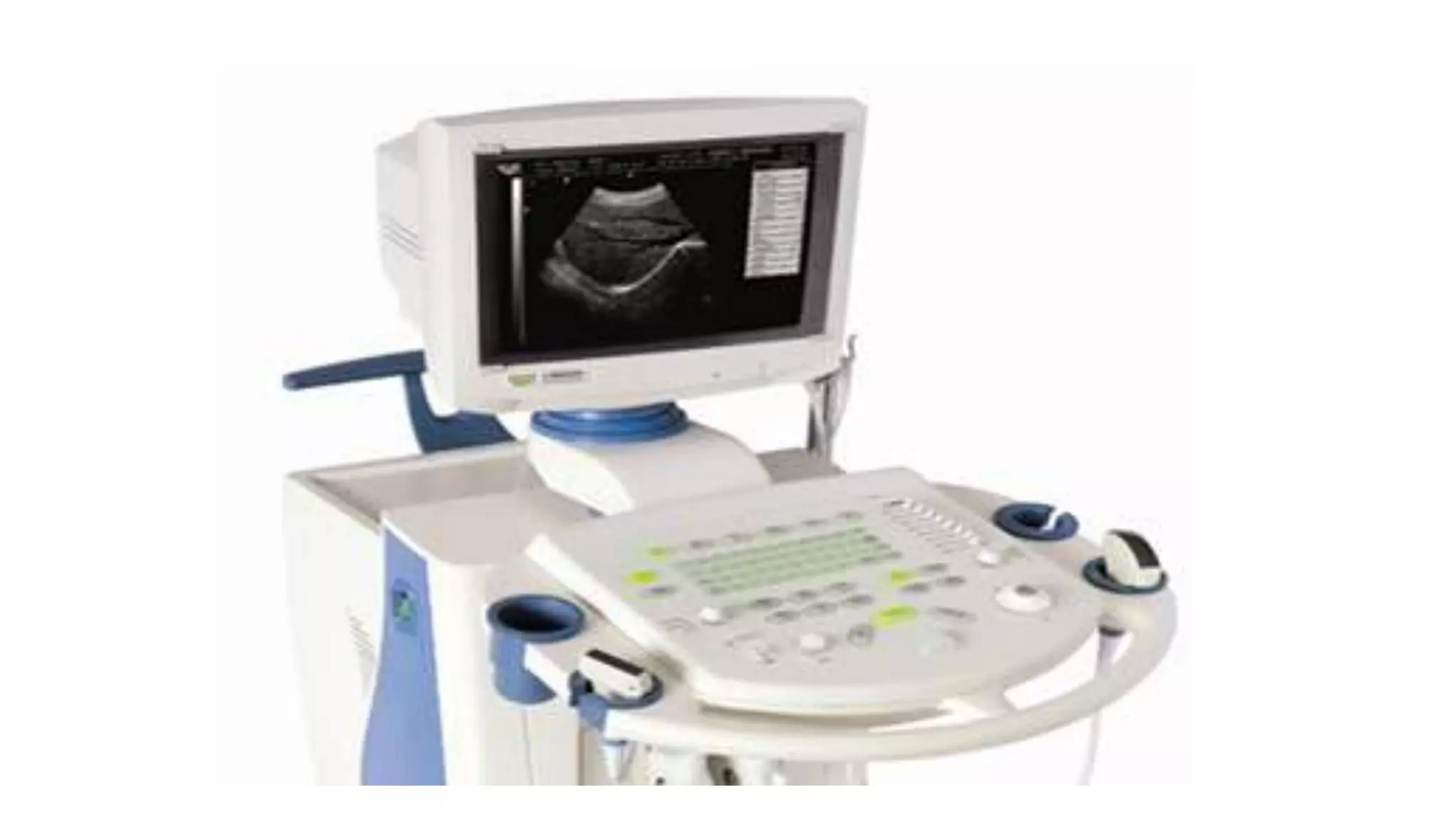 Ultrasound Normal Anatomy of Major Organs | PPTX