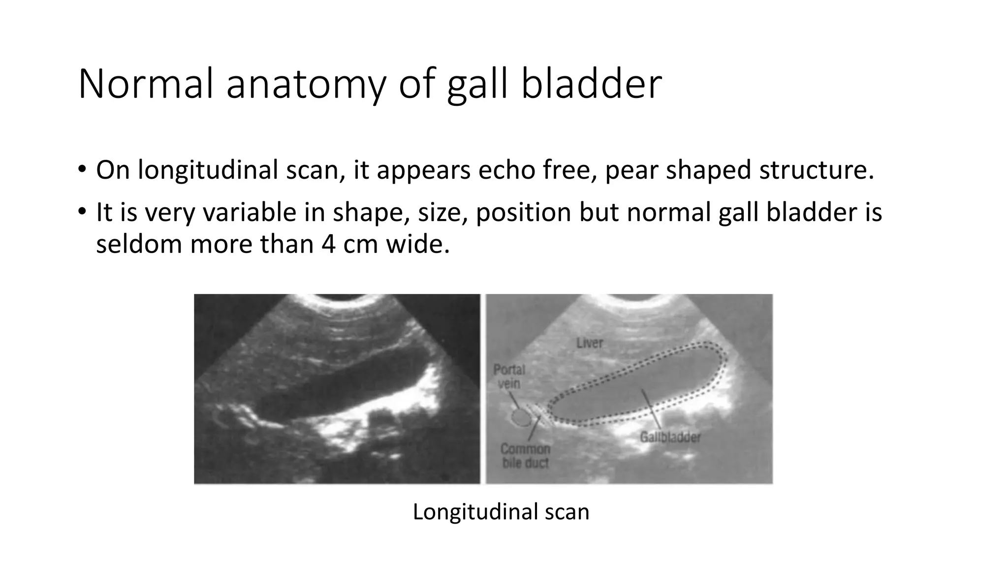 Ultrasound Normal Anatomy of Major Organs | PPTX