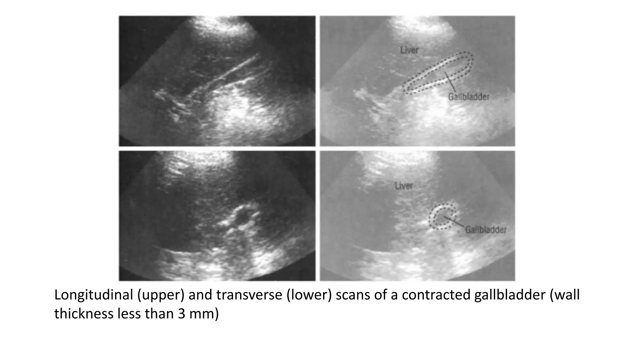 Ultrasound Normal Anatomy of Major Organs | PPTX | Pregnancy ...